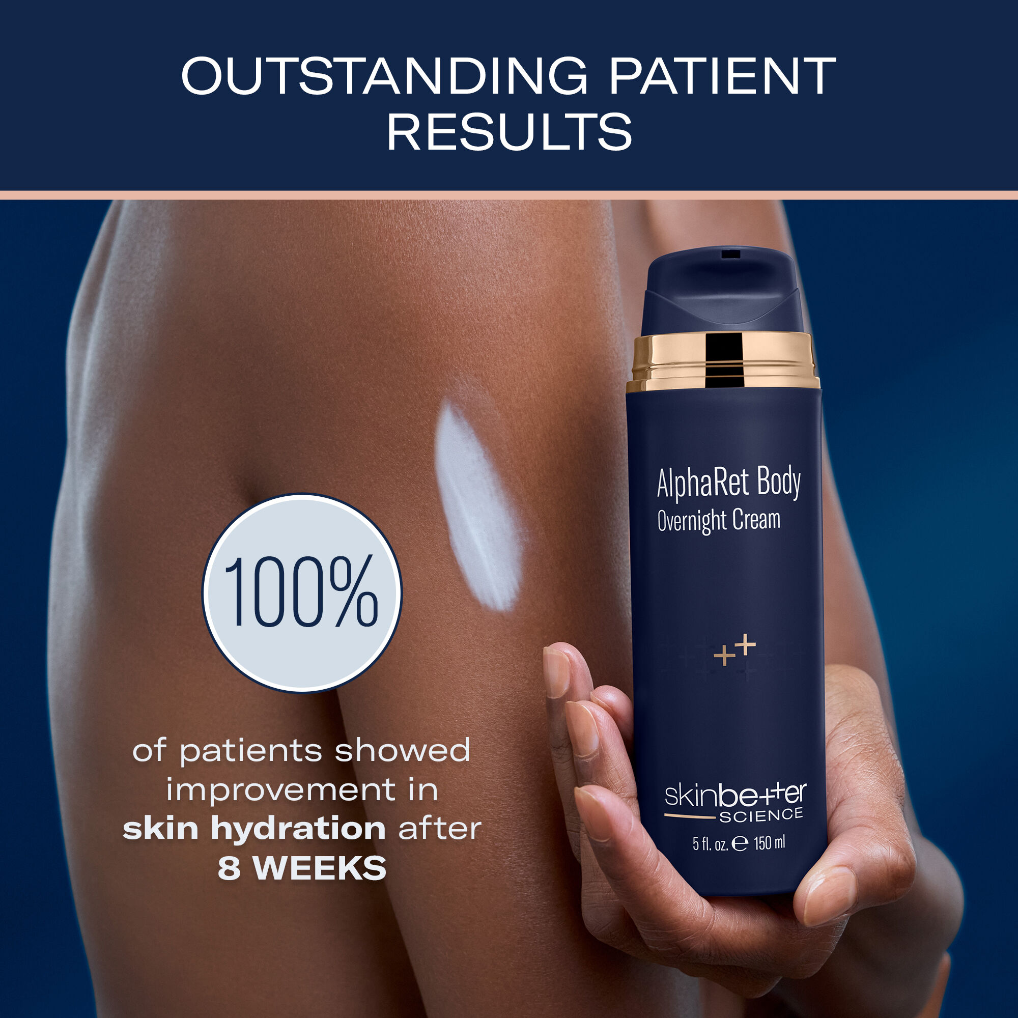 AlphaRet Body Overnight Cream | skinbetter science