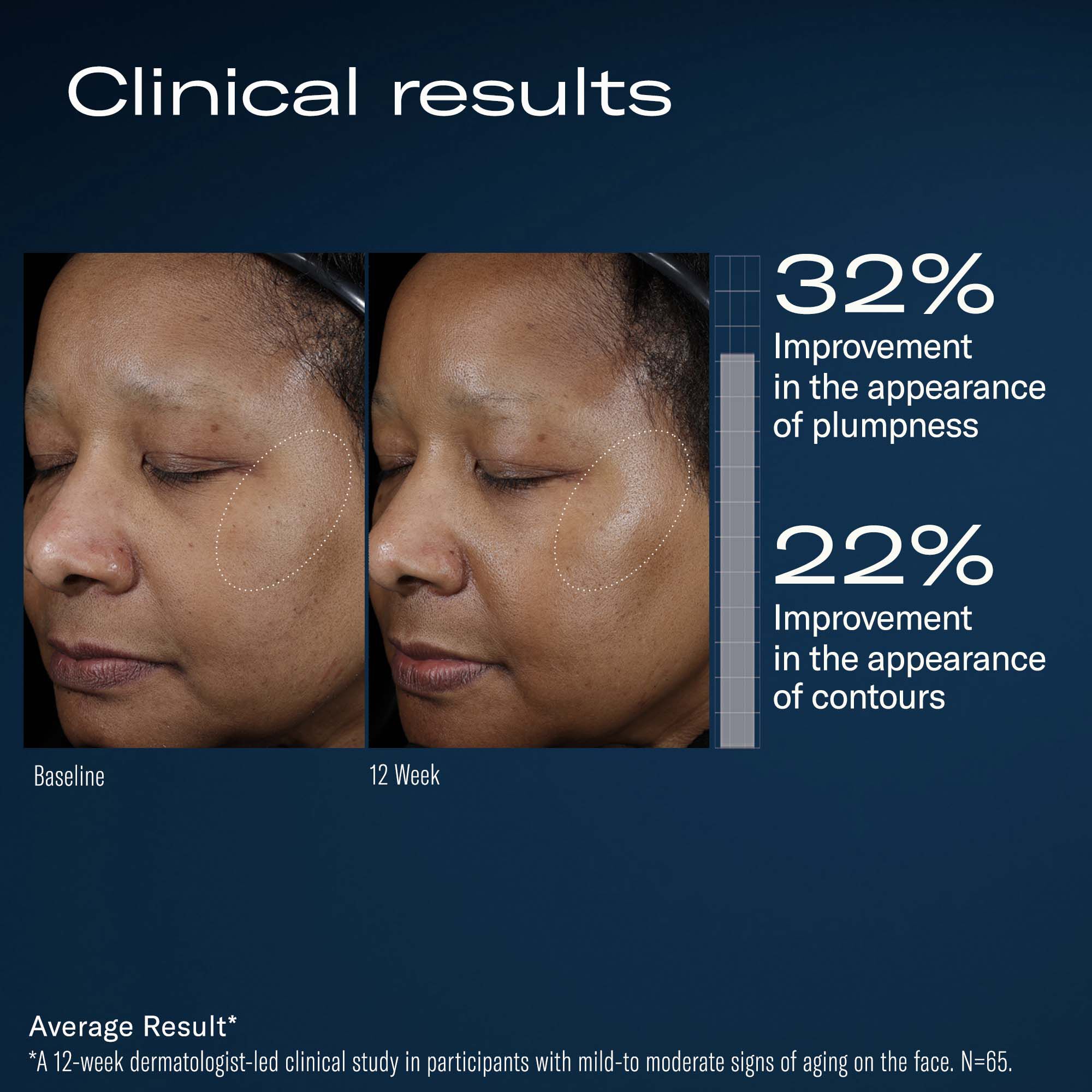 Ampra Volumizing Macro HA Serum | skinbetter science