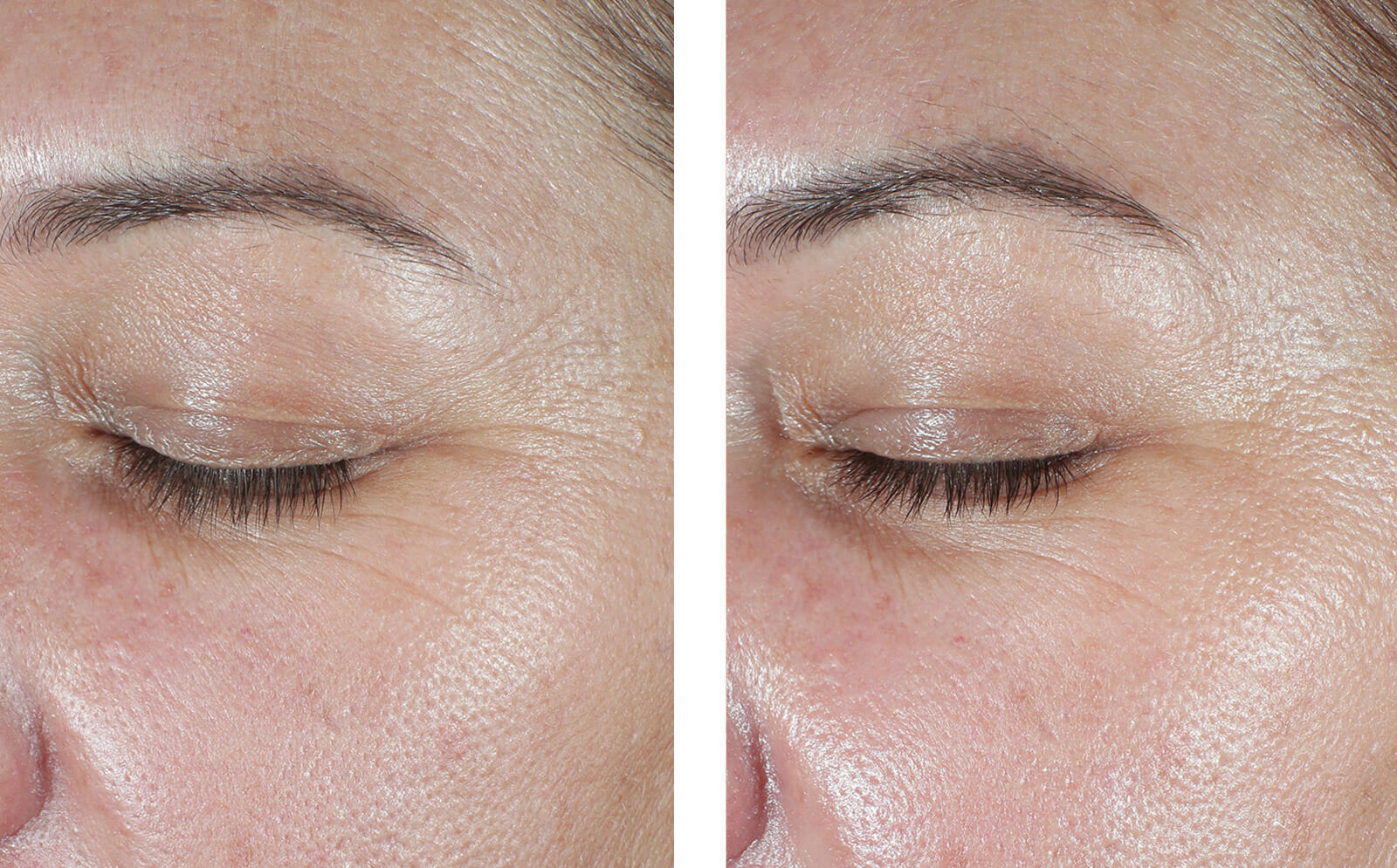 EyeMax AlphaRet Overnight Eye Cream | skinbetter science