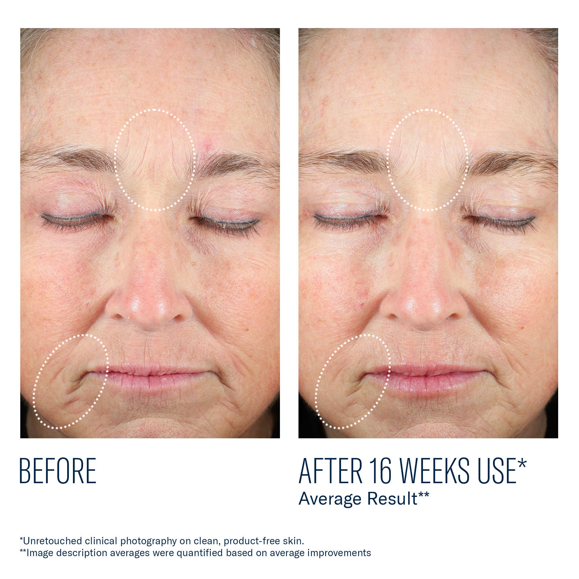 Mystro Revive| skinbetter science