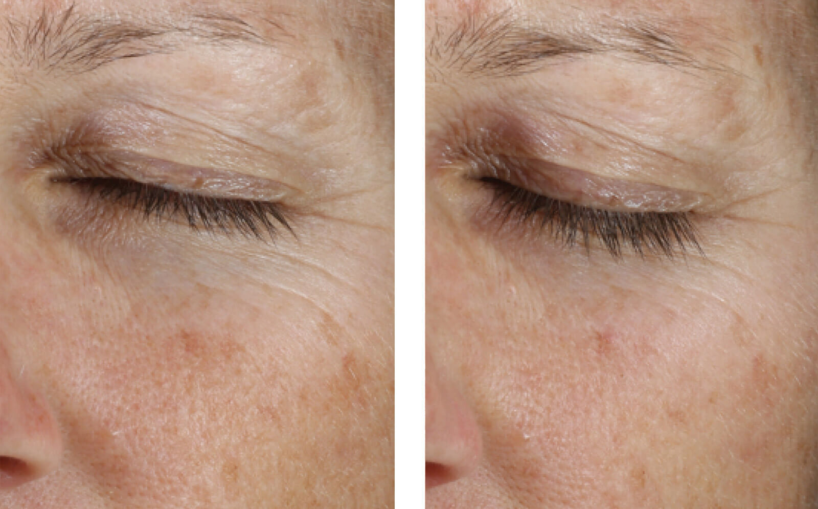 Instant Effect Gel EYE | Eye Care | skinbetter science